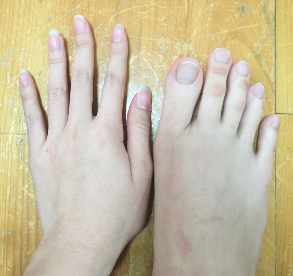 This Woman Is Baffling The World With Her Creepy Feet With Toes Like This Woman Is Baffling The World With Her Creepy Feet With Toes Like