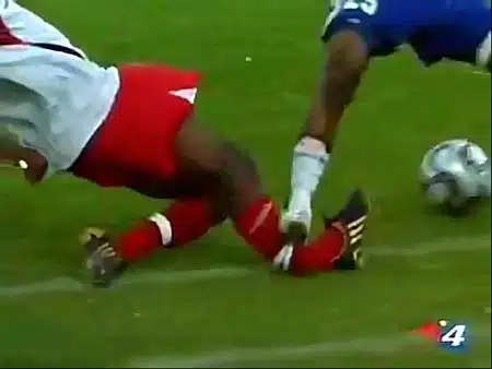 Is This The Worst Leg Break In Football History?