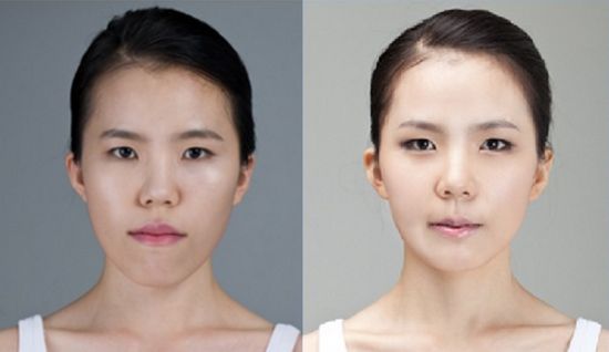 Crazy Before And After Photos Of South Korean Plastic Surgery