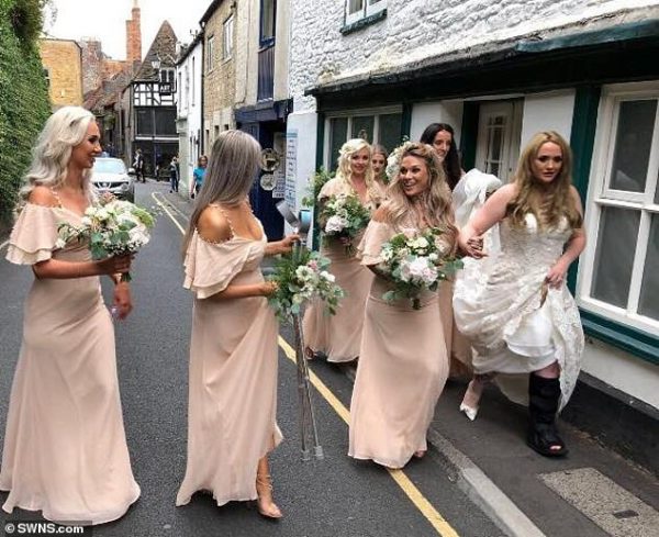 Bride Breaks Her Leg & Nearly Has It Amputated In Bachelorette Party ...