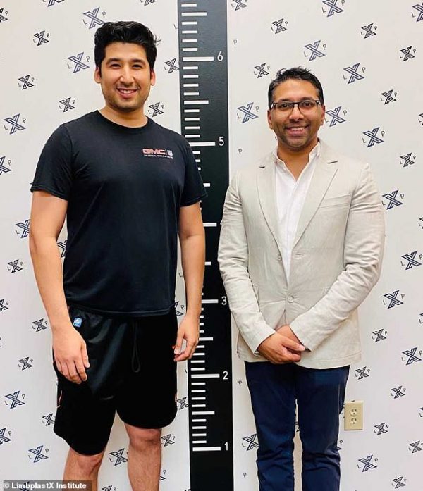 5 11 Man Undergoes Surgery To Lengthen His Limbs And Become 6 1 5 11 Man Undergoes Surgery To Lengthen His Limbs And Become 6 1