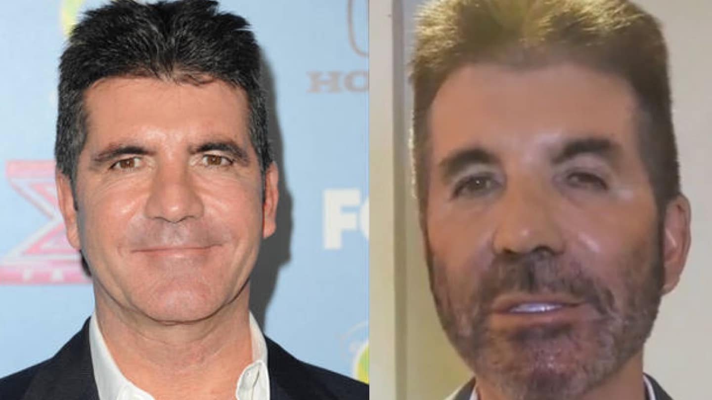 Simon Cowell Deletes Tweet After Fans Are Concerned About His Weird Face Simon Cowell Deletes Tweet After Fans Are Concerned About His Weird Face