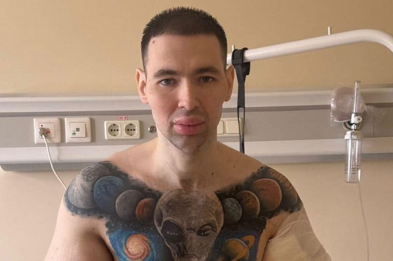 Russian Popeye Who Injected Oil Into His Biceps 'Faces Amputation'